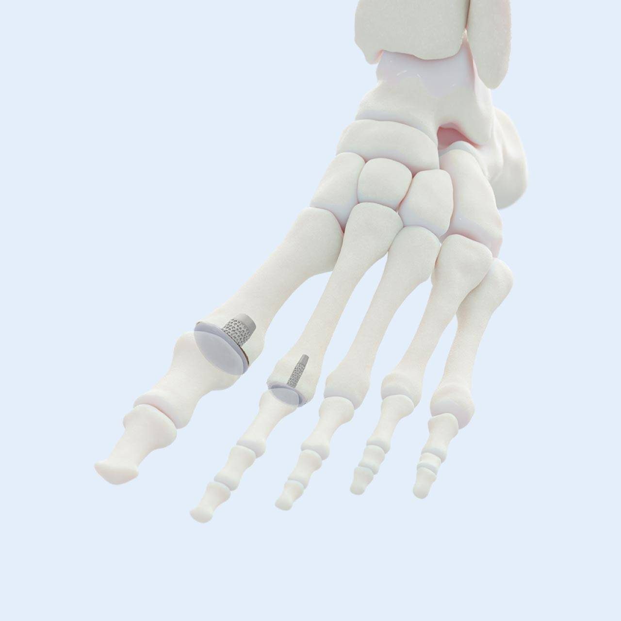 BioPoly | Advancing Materials. Advancing Outcomes.