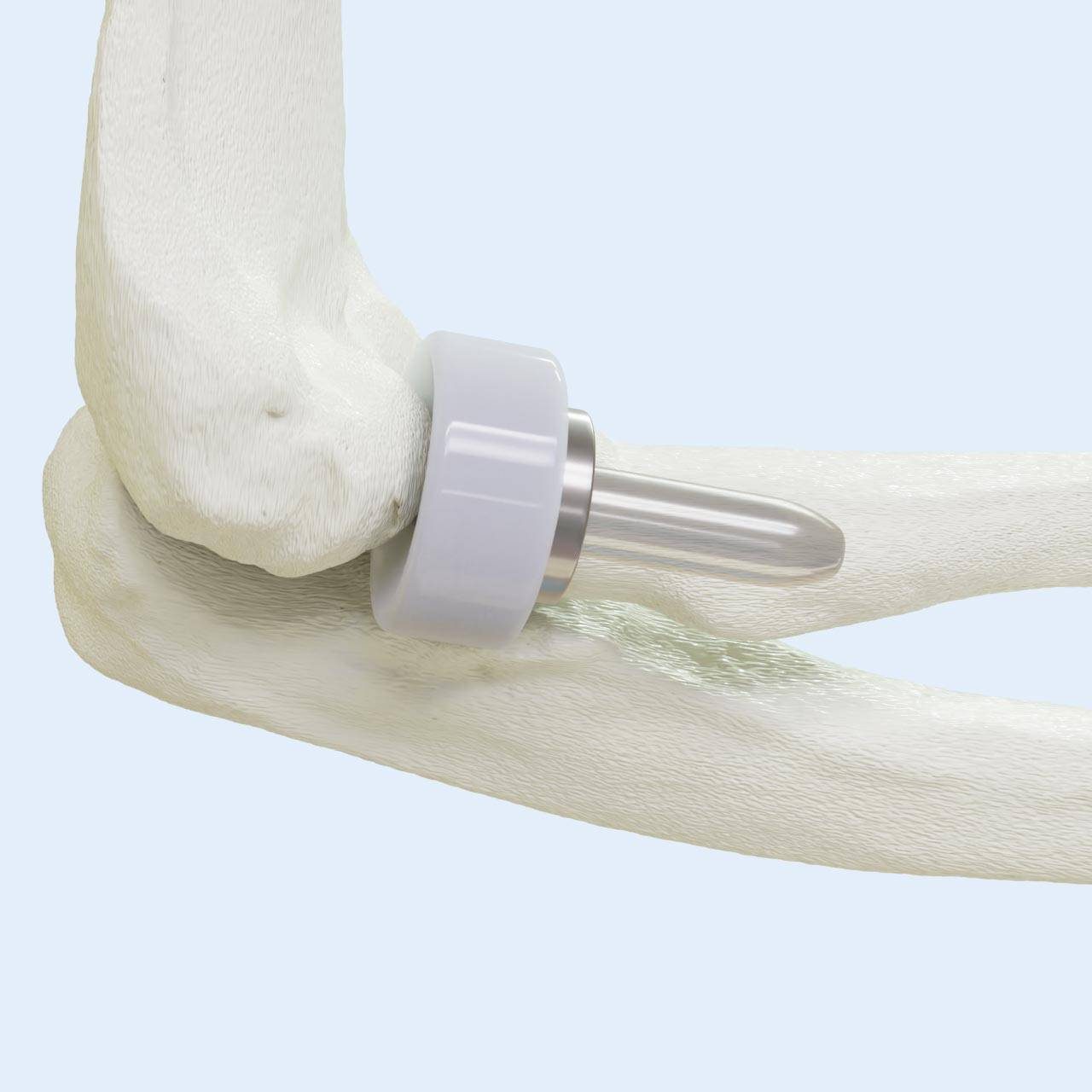 BioPoly | Advancing Materials. Advancing Outcomes.